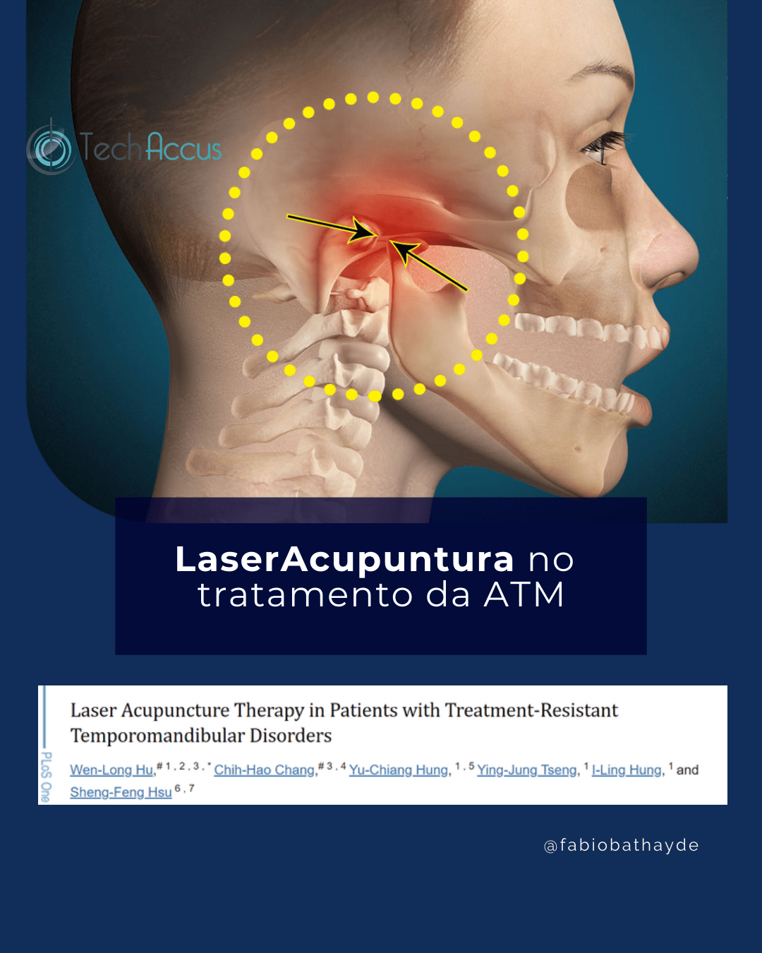 LaserAcupuntura no tratamento da ATM / DTM | Dr. Fábio B. Athayde ...