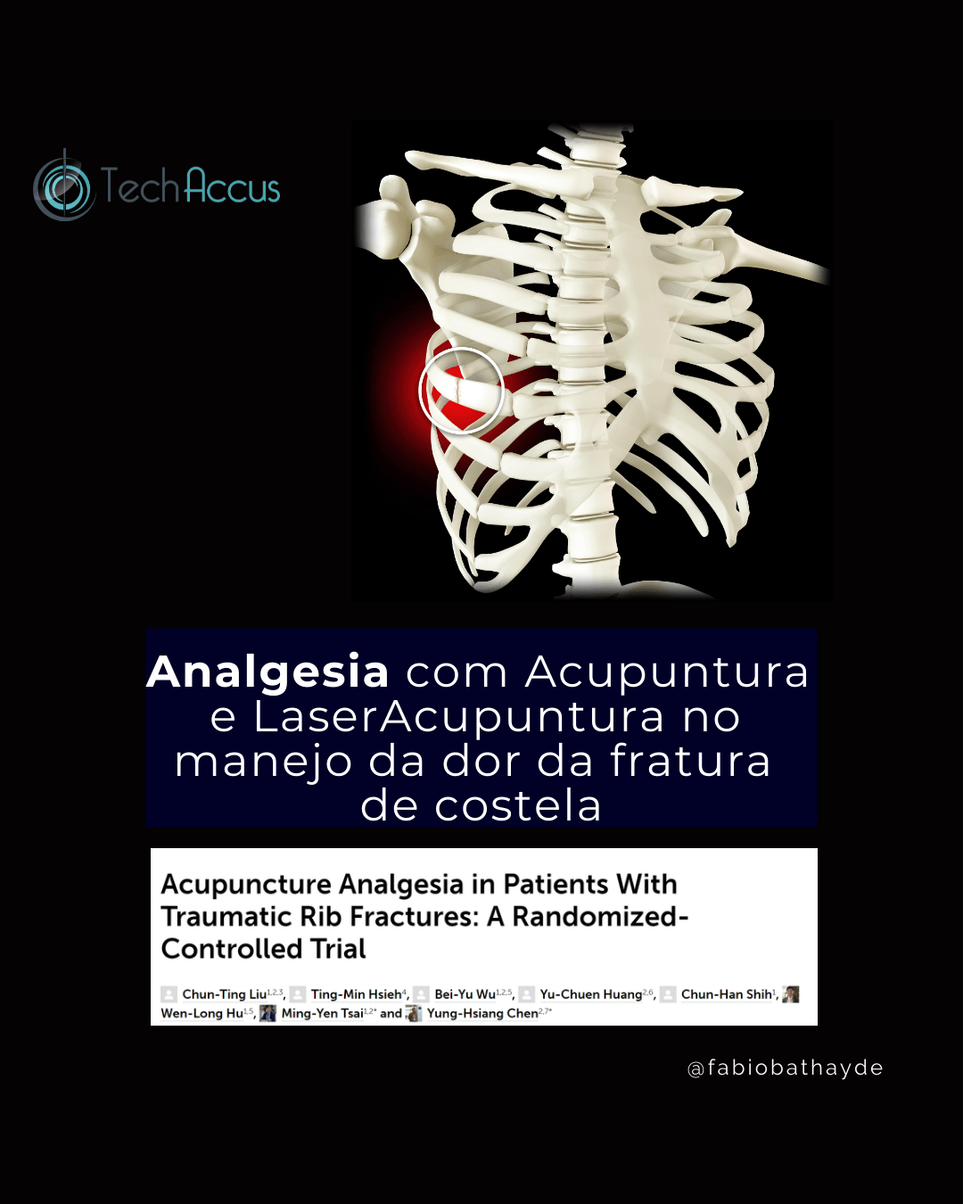 Acupuntura e LaserAcupuntura no manejo da dor da fratura de costela | Dr. Fábio B. Athayde ...