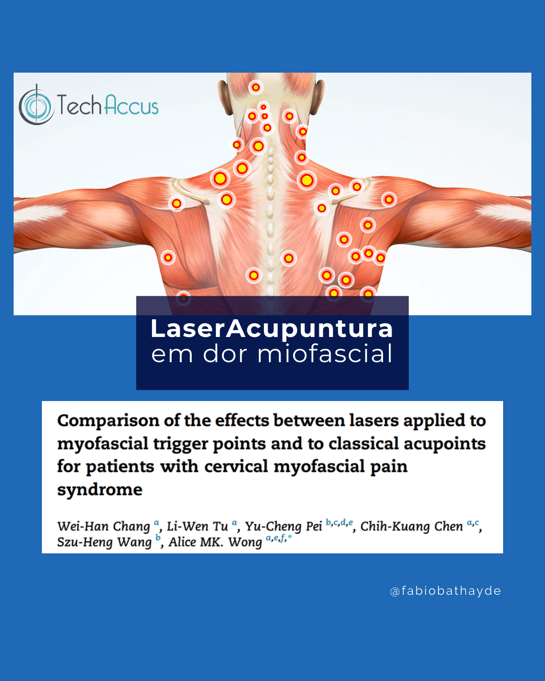 LaserAcupuntura em dor Miofascial | Dr. Fábio B. Athayde - Acupuntura ...